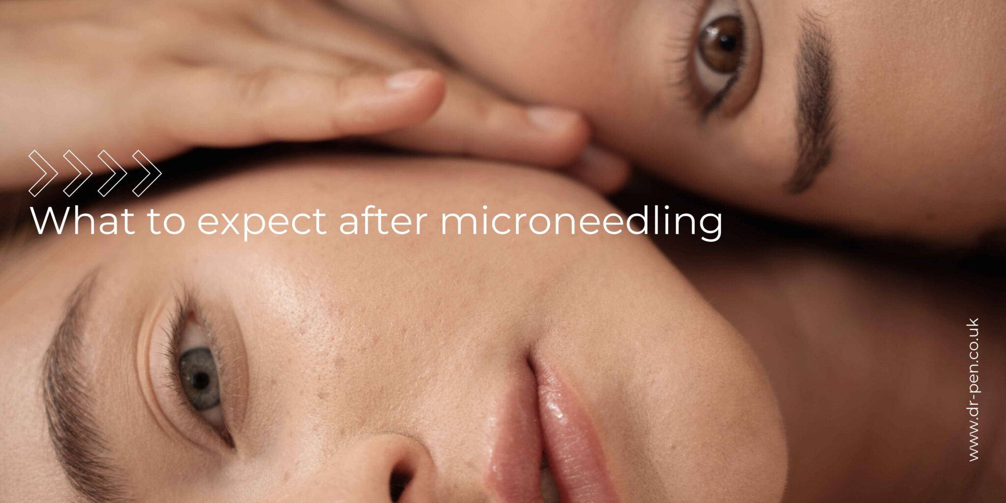 After Microneedling: Healing & Care Tips – Dr Pen UK